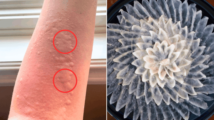Foods That Become Poisonous If You Make the Wrong Cooking Move - So ...